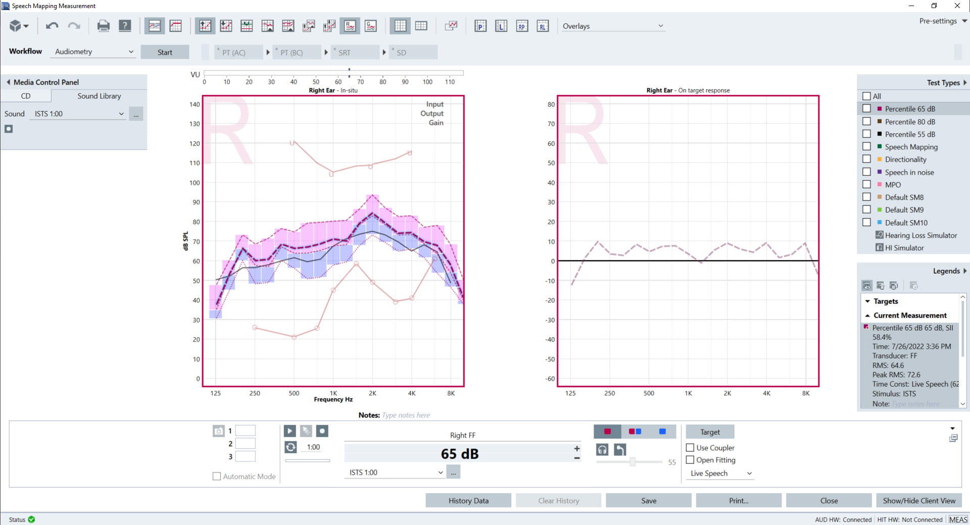 Speech mapping | Audio Service